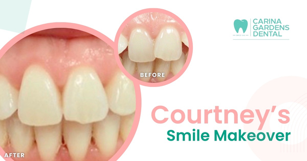 Dental Patient Journeys | Brisbane Dentist | Carina Gardens Dental