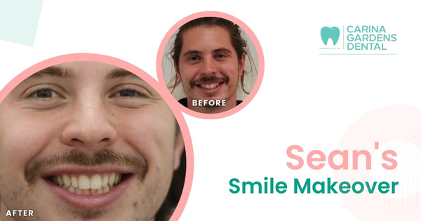Dental Patient Journeys | Brisbane Dentist | Carina Gardens Dental